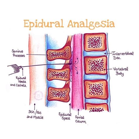 Labor Delivery Nursing Labor Nurse Nursing Students Nursing School