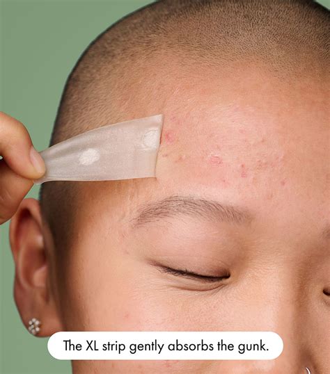 Mighty Patch Surface 10s