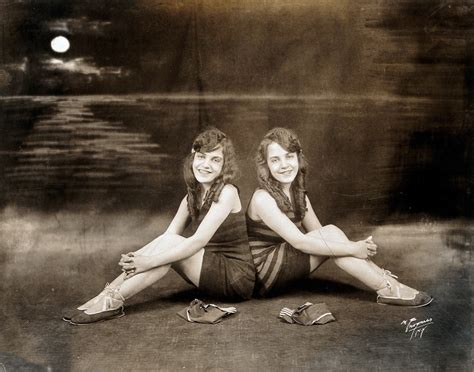 40 Vintage Photographs And The Tragic Life Of Conjoined Twins Daisy