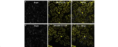 Subcellular Localization Patterns Of Δp4 117 138 Yfp And Δp4