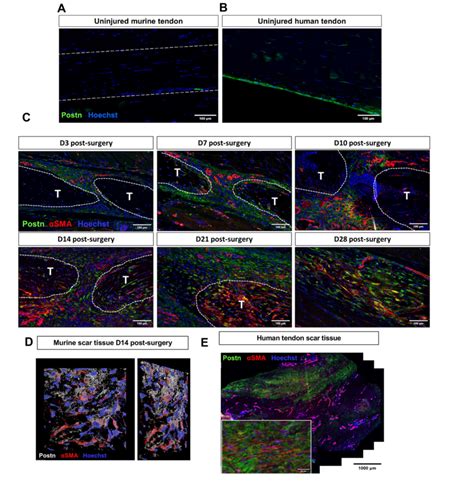 Periostin Expression Is Dynamic During Tendon Healing A During