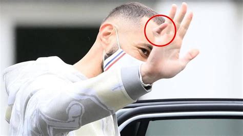 El Misterio De La Mano De Benzema Todo Por El Madrid Y Operación