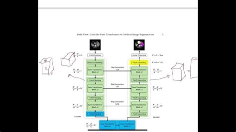 Swin Unet Unet Like Pure Transformer For Medical Image Segmentation Youtube