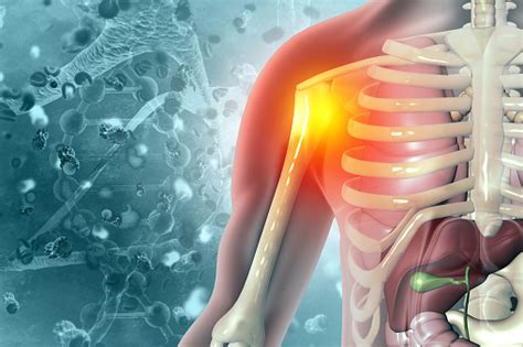 인간의 어깨 관절 통증 어깨 인대 건염 어깨 근육 긴장 3d 일러스트레이션 골관절염에 대한 스톡 사진 및 기타 이미지 골관절염 0명 3차원 형태 Istock