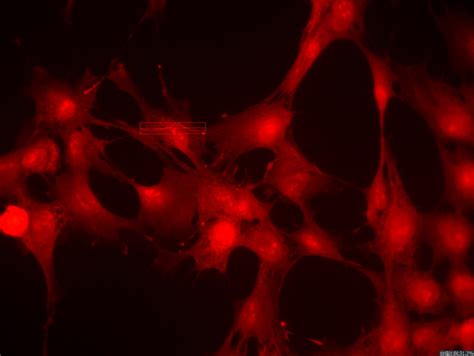 不止imagej：怎么快速实现径向荧光强度分析？