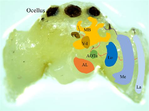 Frontal View Of Morphological Connectivity Of Visual Pathway Download
