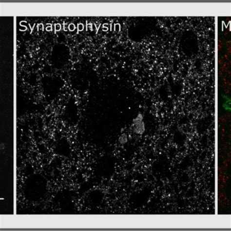 High Resolution Array Tomography Imaging Reveals Plaque Associated Download Scientific Diagram
