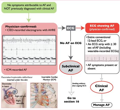 Best 13 Atrial Fibrillation Symptoms How Do You Know If You Have Afib Artofit