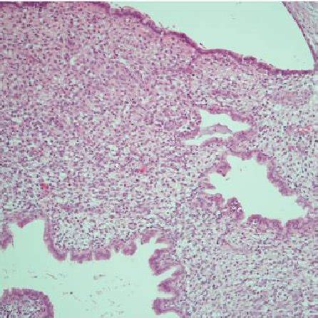 Standing Spinal X Rays Shows A Compression Fracture Of T7 Vertebral Download Scientific Diagram