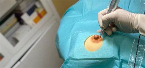 22 Mujeres Se Han Tatuado La Areola En El Hospital En El último Año Y Medio El Correo