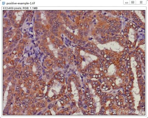 Imagej灰度值量化分析 实用技巧——免疫组化分析定量分析篇免疫组化定量分析imagej Csdn博客