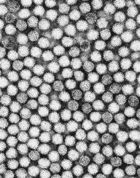 Hepatitis B Virus 5 Photograph By Science Photo Library Pixels
