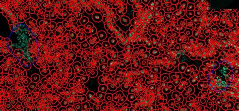 Cell Segmentation In Qupath With Multiple Images Image Analysis
