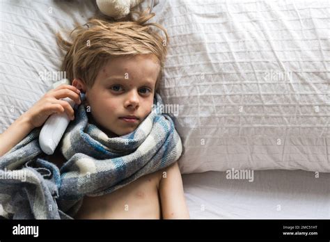 Jungkind Mit Windpocken Krankes Kind Mit Windpocken Varizellen Virus