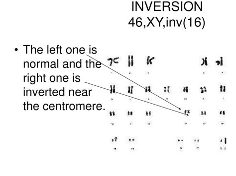 Ppt Karyotypes And Mutations Powerpoint Presentation Free Download