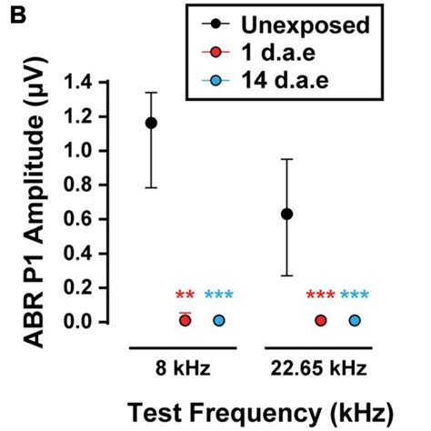 Exposure To 120 Db Sound Pressure Level Spl Noise At P15 Induces A