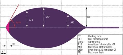 Rotem Parameters Reprinted From Rotem Website 19 With Permission Download Scientific Diagram