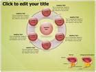 Professional Benign Prostatic Hyperplasia Editable PowerPoint Template