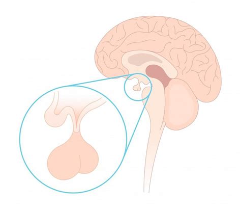 What Caused My Pituitary Gland Damage The Endocrine Center