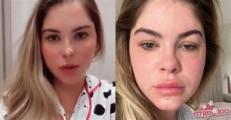 B Rbara Evans Compartilha Fotos De Seu Corpo Inchado Por Conta De Tratamento Para Engravidar