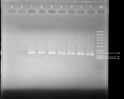 Gel Photograph Showing Nested Pcr Amplified Products From Different