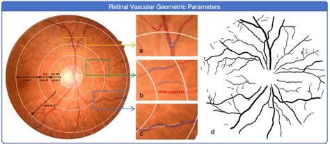 Schematic Diagram Of A Retinal Vessel Branching Angle B Retinal