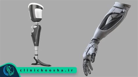 پروتز هوشمند دست و پا کلینیک ارتوپدی فنی کوشا