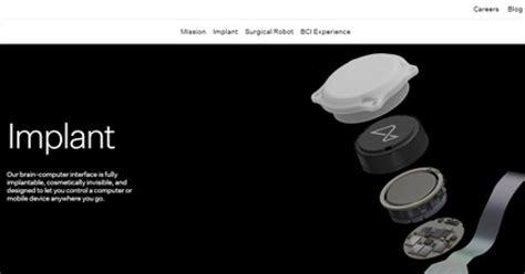 머스크 사람 뇌에 처음으로 칩 이식”뇌 컴퓨터 연결