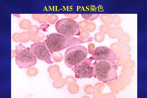 Ppt M M A
