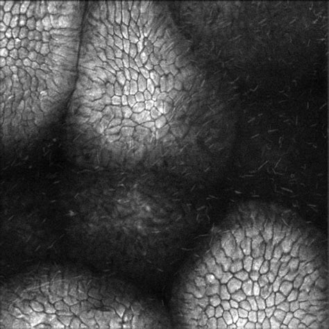 Cem Image Demonstrating Non Helicobacter Pylori Helicobacters Nhph In Download Scientific