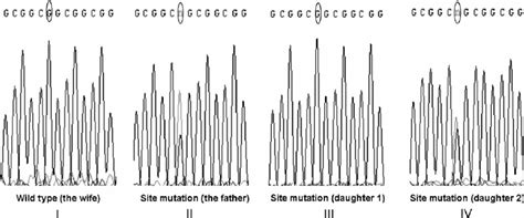 Sequencing Traces Showing The Silent Variation Of Runx2 In Case 1