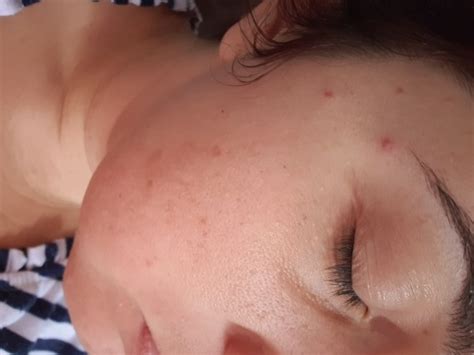 Proactiv 3 Step System Product Review