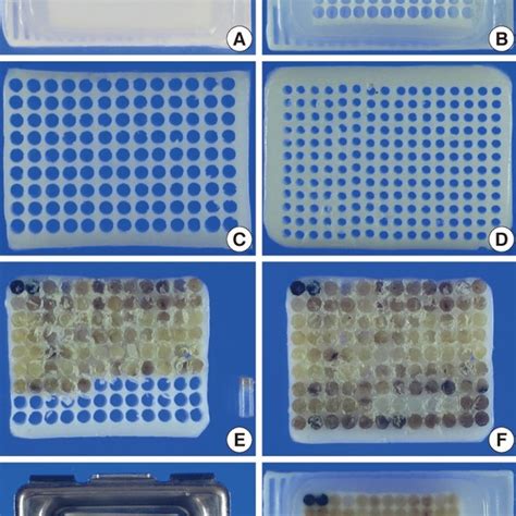 Tissue Processing Protocols Used For Preparation Of The Agarose Gel To Download Scientific