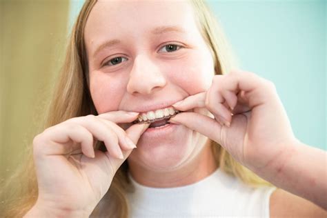 Retainers Ortho Co Parramatta And Canterbury