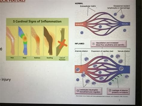 Week 6 Asynchronous Flashcards Quizlet