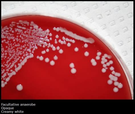 Staphylococcus Saprophyticus Medical Laboratories