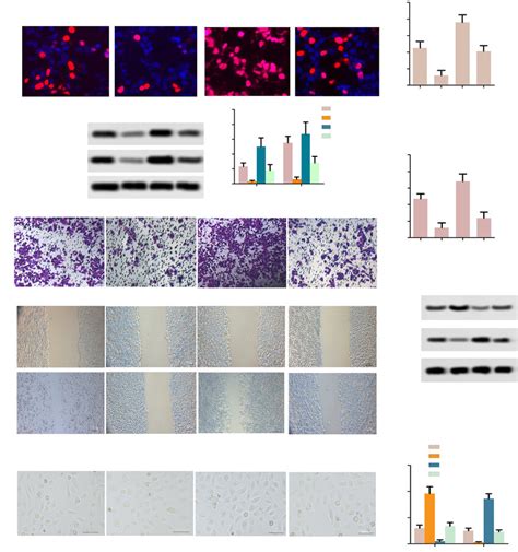 Sh Hulc Suppressed The Invasion And Migration Abilities Of Hepg2 Cells