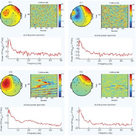 Pdf Automatic Artifact Suppression In Simultaneous Tdcs Eeg Using Adaptive Filtering
