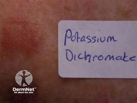 Patch Test Image