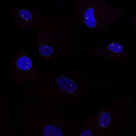 Identifying Primary Objects Not Completely In Full View Image Analysis Imagesc Forum