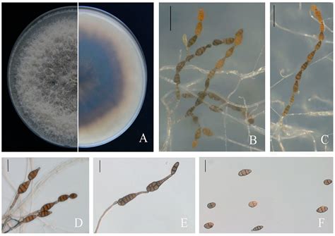 Alternaria Alternata