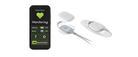 Infobionic Ai The Mome Arc® Infobionic Ais Mome Arc® Enabling The Future Of Diagnostic