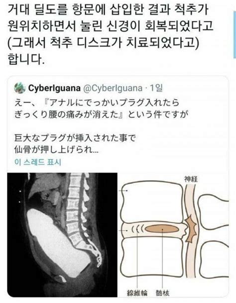 거대 딜도 항문에 삽입 후기 일반 유머 sub 시보드