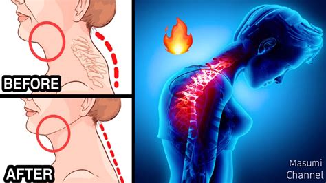 Best Exercises To Lift Your Nose Tip Reshape Nose Fat