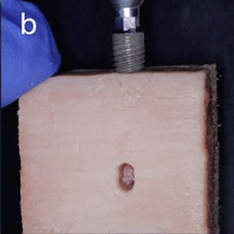 Insertion Of Titanium Implants Into The Three Groups Of The Blocks