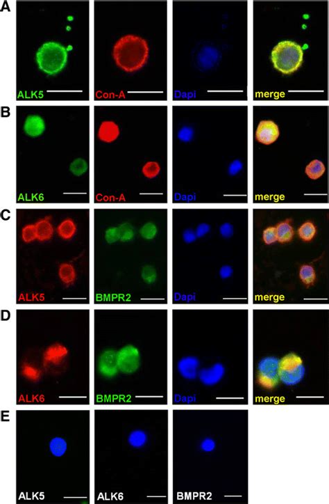 Representative Immunocytochemical Labeling Of Tgfb Receptors In Human