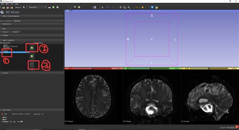 使用3d slicer进行图像配准 csdn博客