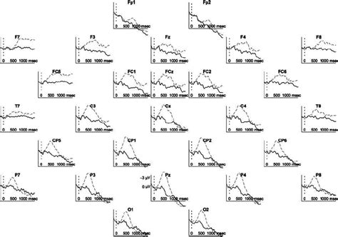 Semantic Anomaly Effect Grand Average ERPs To Words Whose Meaning Was Download Scientific