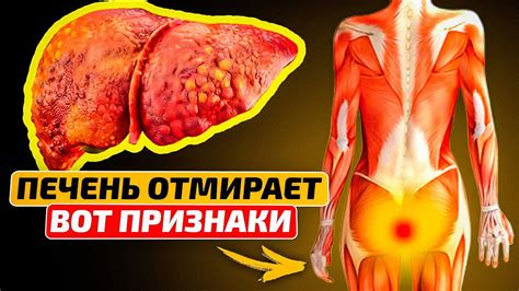 13 ранних Признаков того что ваша ПЕЧЕНЬ ОТМИРАЕТ 90 с проблемами печени даже не догадываются
