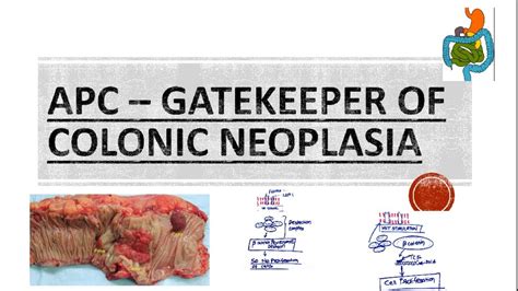 Apc Gene Gatekeeper Of Colonic Neoplasia Wnt Beta Catenin Pathway Youtube